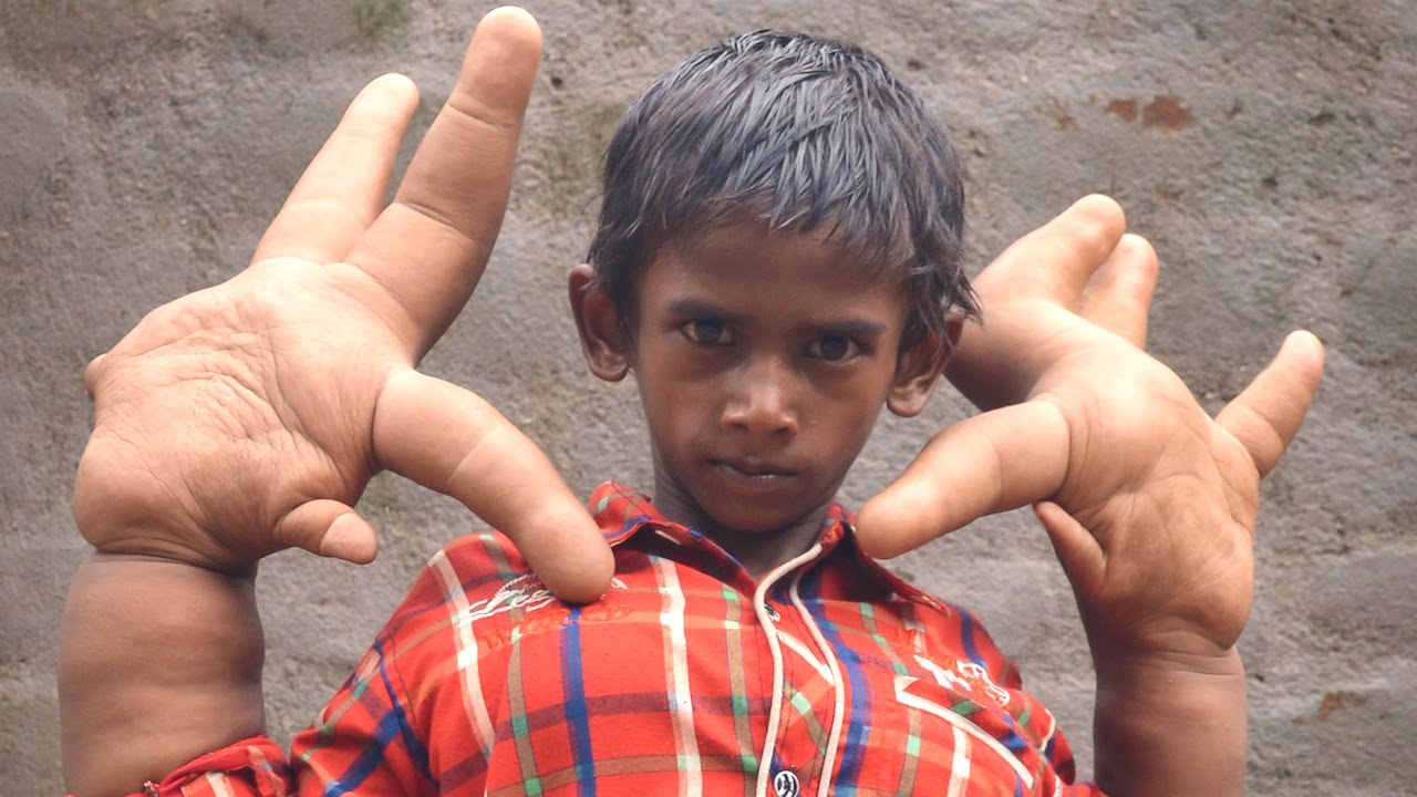 Un enfant avec des mains géantes - Welovebuzz